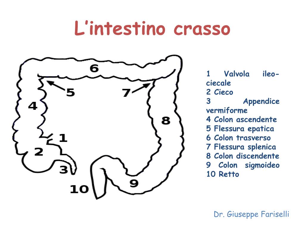 PPT - Il carcinoma intestinale PowerPoint Presentation, free download ...