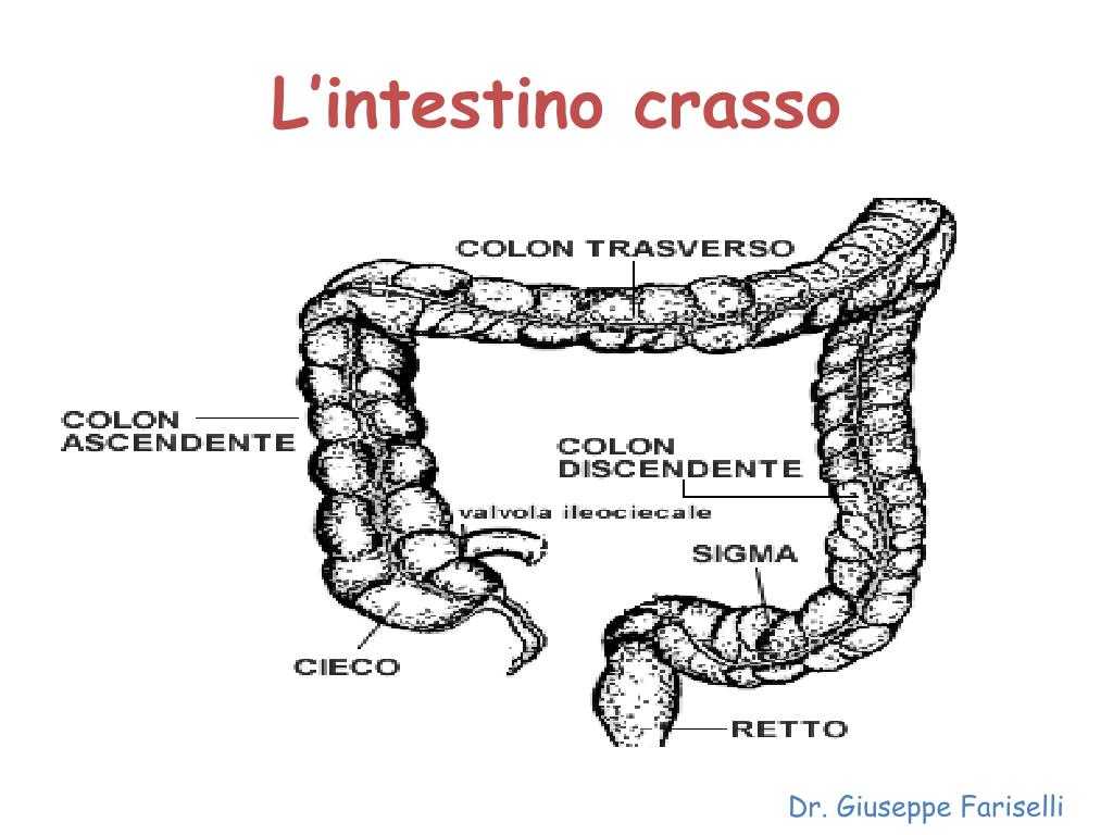 PPT - Il carcinoma intestinale PowerPoint Presentation, free download ...