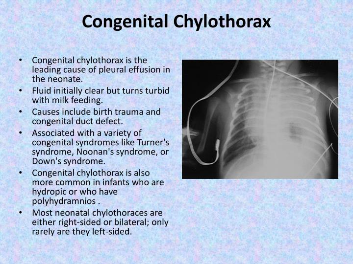 PPT - CHYLOTHORAX PSEUDOCHYLOTHORAX PowerPoint Presentation - ID:5875643