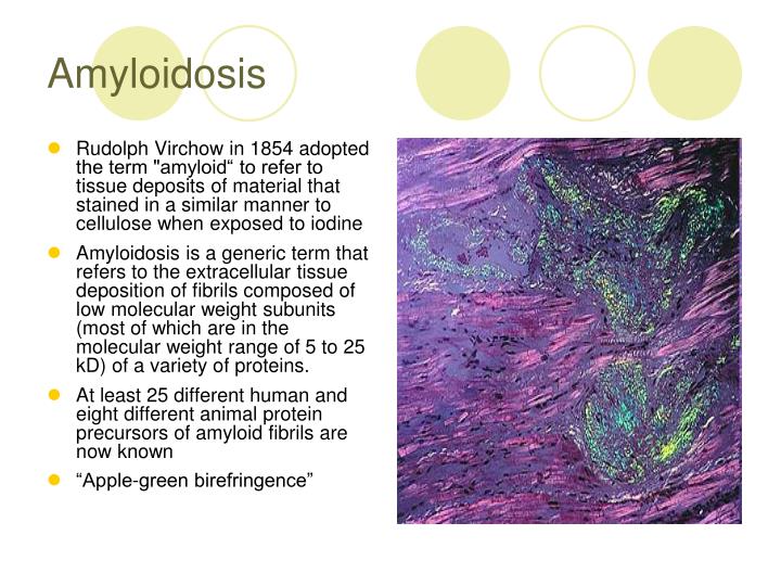 PPT - Cardiac Amyloidosis PowerPoint Presentation - ID:5877977