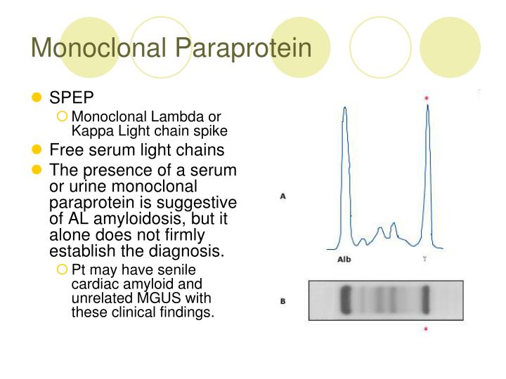 PPT - Cardiac Amyloidosis PowerPoint Presentation - ID:5877977