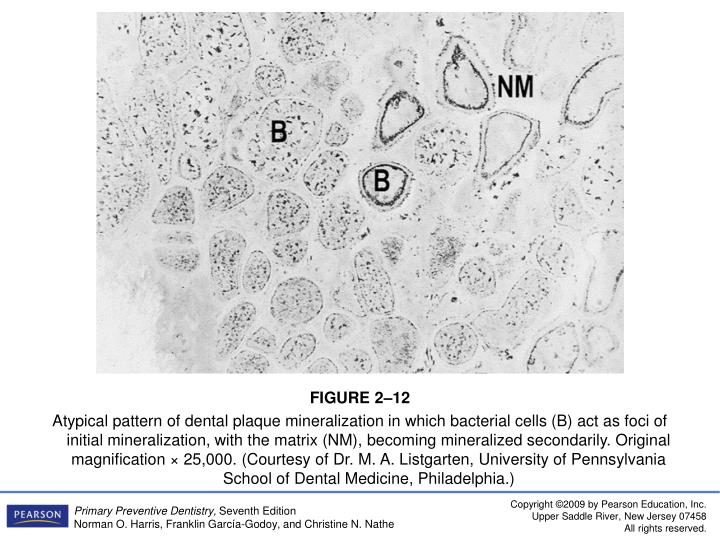 PPT - Chapter 2 Dental Plaque PowerPoint Presentation - ID:5878077