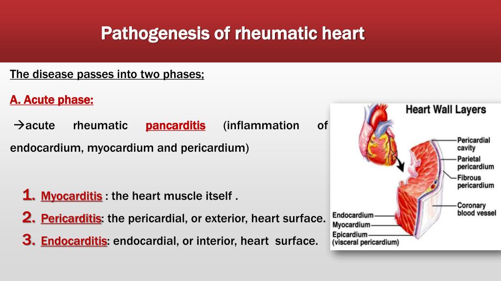 PPT - CARDIOVASCULAR SYSTEM Rheumatic heart disease and valvular ...