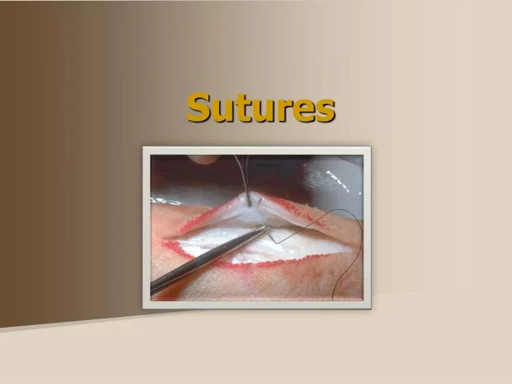 PPT - Sutures PowerPoint Presentation, free download - ID:5880654