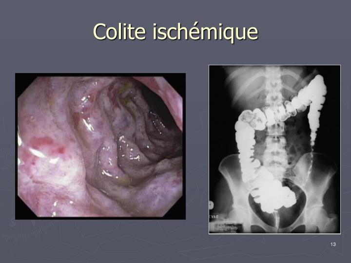 PPT - Anatomie tube digestif PowerPoint Presentation - ID:5882199