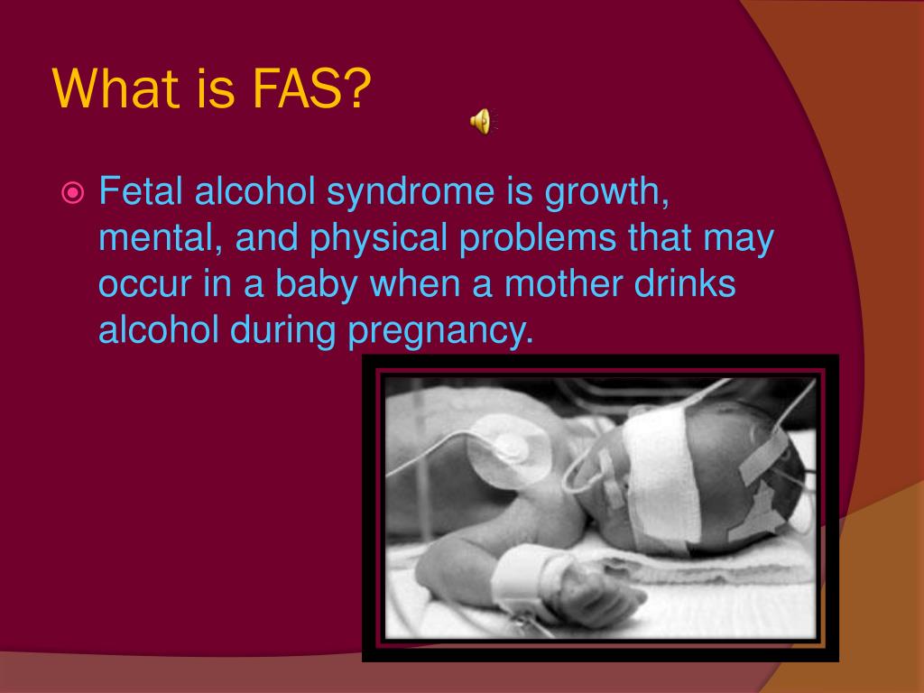 PPT - Fetal Alcohol syndrome PowerPoint Presentation, free download ...