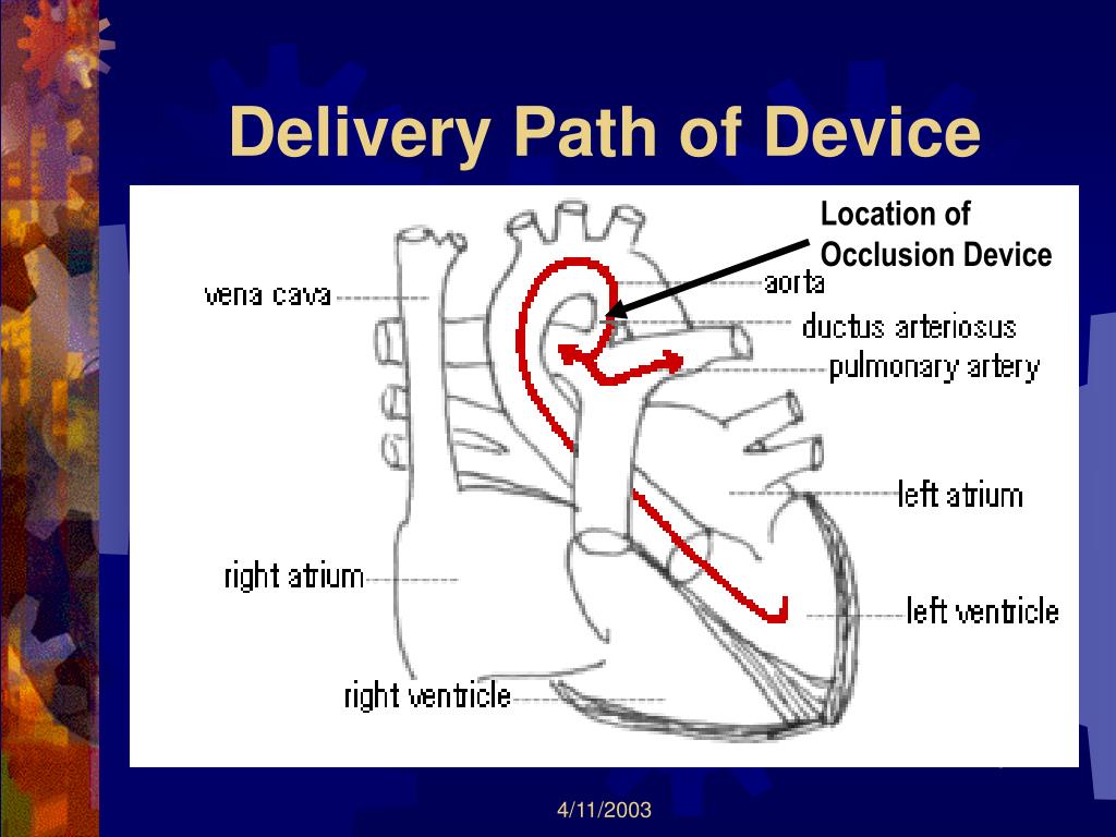Ppt Patent Ductus Arteriosus Occlusion Device Oral Presentation 4