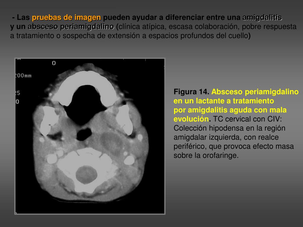 PPT - Urgencias no traumáticas de cabeza y cuello en pediatría ...