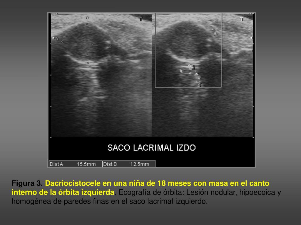 PPT - Urgencias no traumáticas de cabeza y cuello en pediatría ...