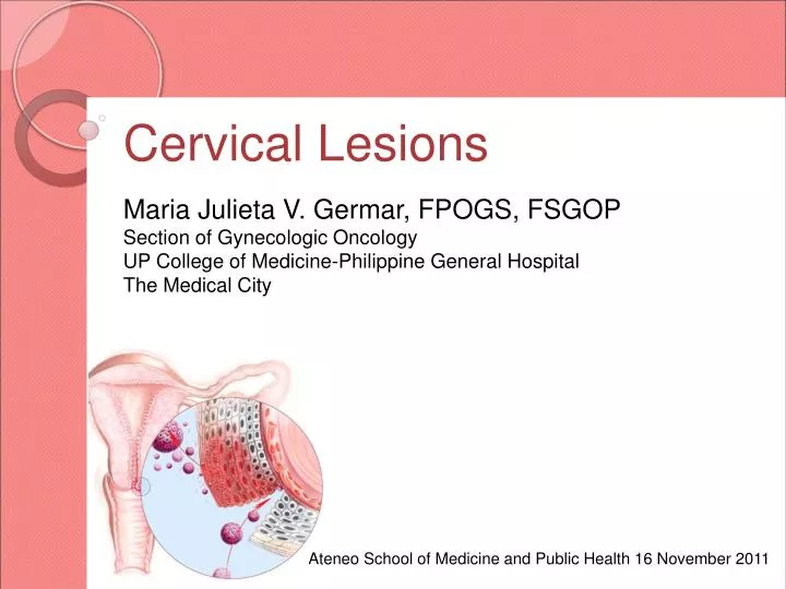 PPT - Cervical Lesions PowerPoint Presentation, free download - ID:5911047