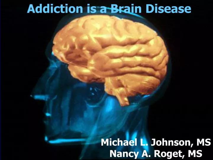 PPT - Addiction is a Brain Disease PowerPoint Presentation, free ...