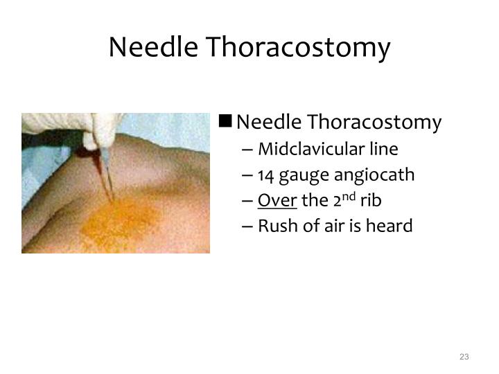 PPT - Trauma PowerPoint Presentation - ID:5914905
