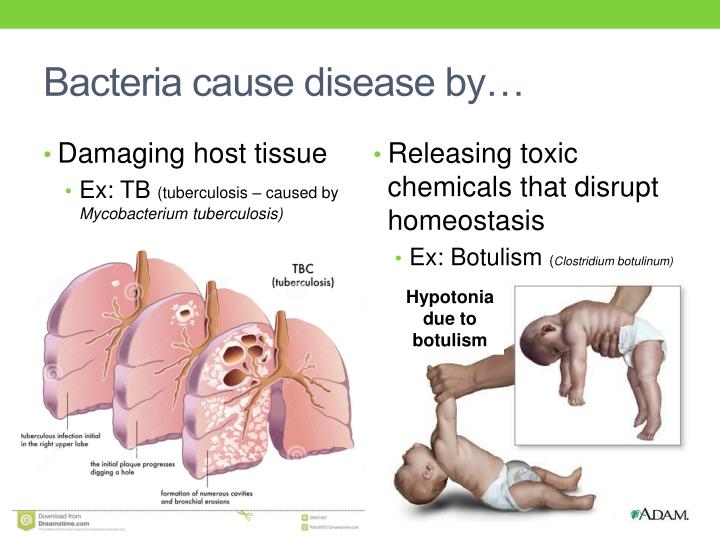 PPT - Bacterial & viral Disease PowerPoint Presentation - ID:5918211