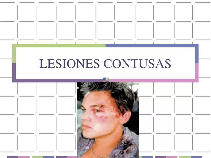 PPT - LESIONES CONTUSAS PowerPoint Presentation - ID:5919786
