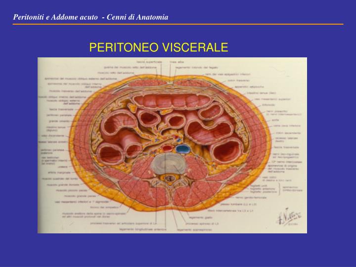 PPT - Addome acuto e peritoniti PowerPoint Presentation - ID:5921880