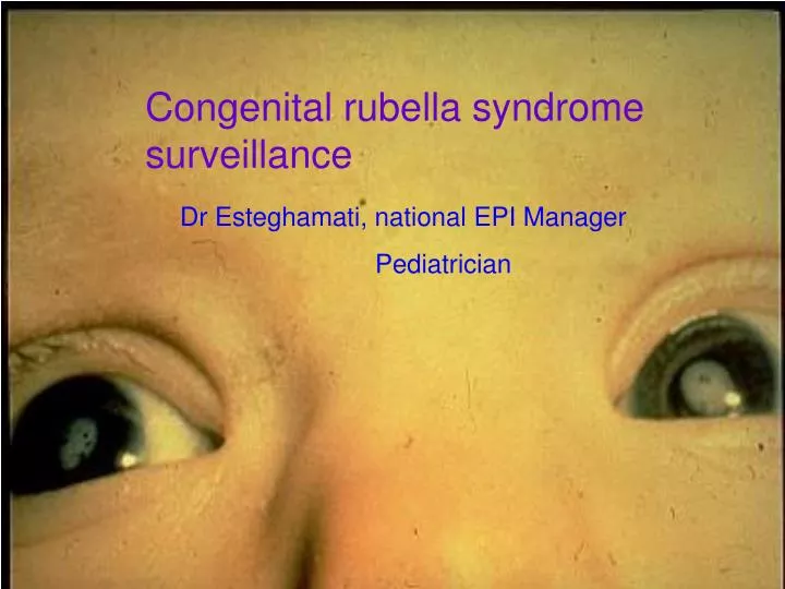 PPT - Congenital rubella syndrome surveillance PowerPoint Presentation ...