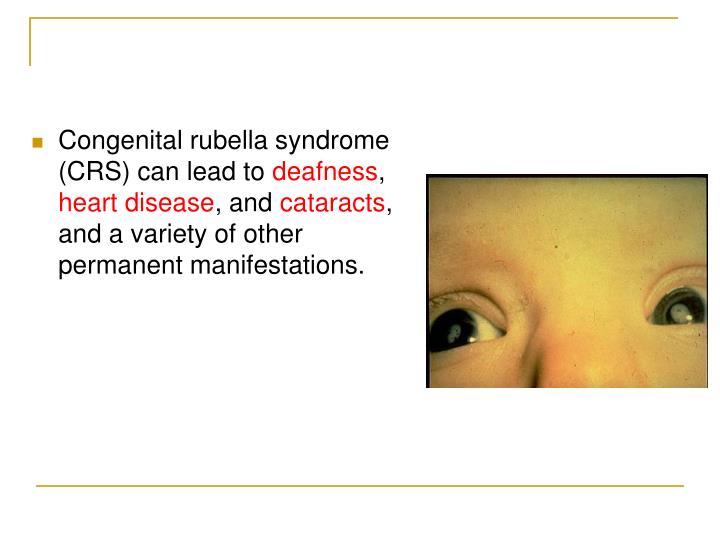 PPT - Congenital rubella syndrome surveillance PowerPoint Presentation ...