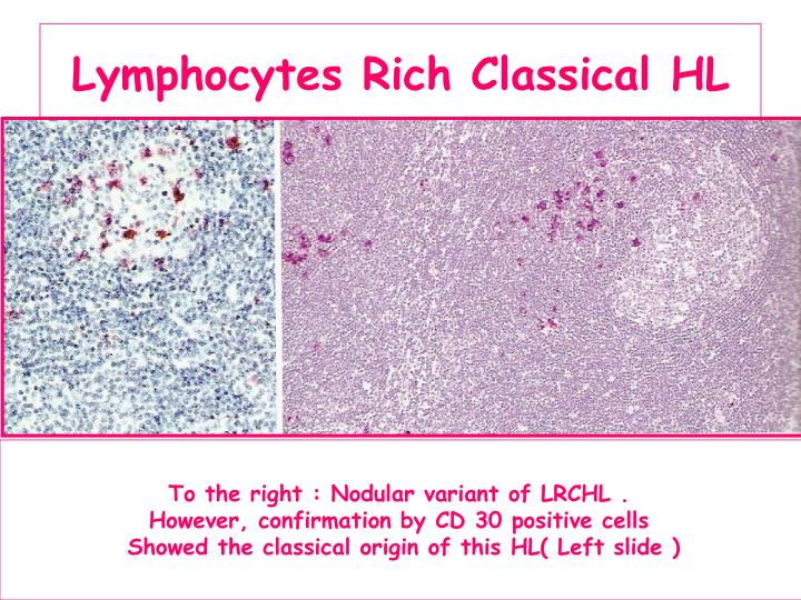 PPT - Lymph node histology PowerPoint Presentation - ID:5931133