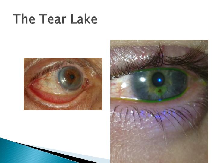 PPT - The Tear Evaluation PowerPoint Presentation - ID:5931643