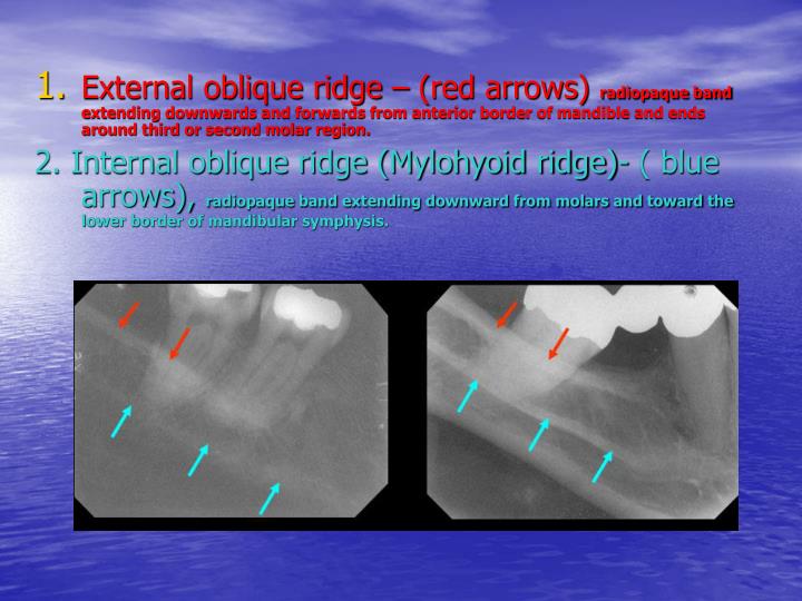 PPT - Normal Anatomic Landmarks of The Mandible PowerPoint Presentation ...