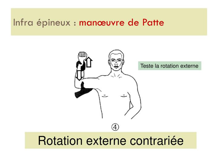 PPT - Pathologie abarticulaire PowerPoint Presentation - ID:5943493