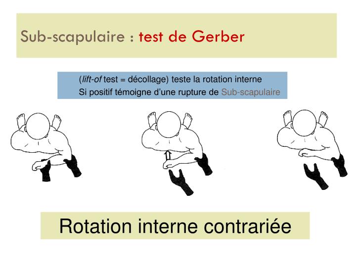 PPT - Pathologie abarticulaire PowerPoint Presentation - ID:5943493