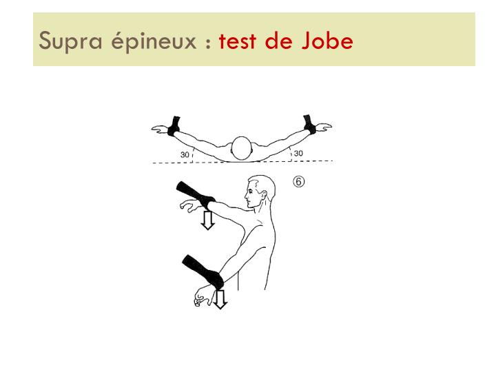 PPT - Pathologie abarticulaire PowerPoint Presentation - ID:5943493