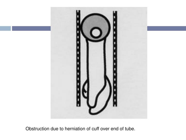 PPT - TRACHEOSTOMY CARE PowerPoint Presentation - ID:5949140