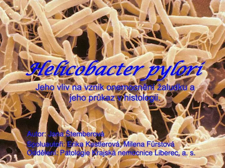 PPT - Helicobacter pylori PowerPoint Presentation, free download - ID ...