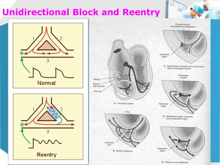 PPT - PHARMACOLOGY OF ANTI-ARRHYTHMICS PowerPoint Presentation - ID:5959708