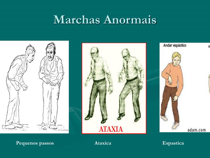 PPT - Semiologia Médica II Exame Neurológico PowerPoint Presentation ...