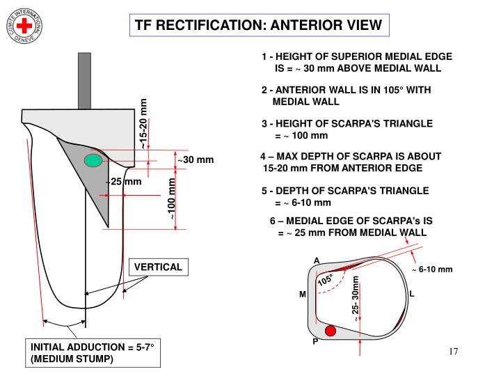PPT - MEASUREMENTS, CASTING & RECTIFICATION FOR TRANS-FEMORAL (TF ...