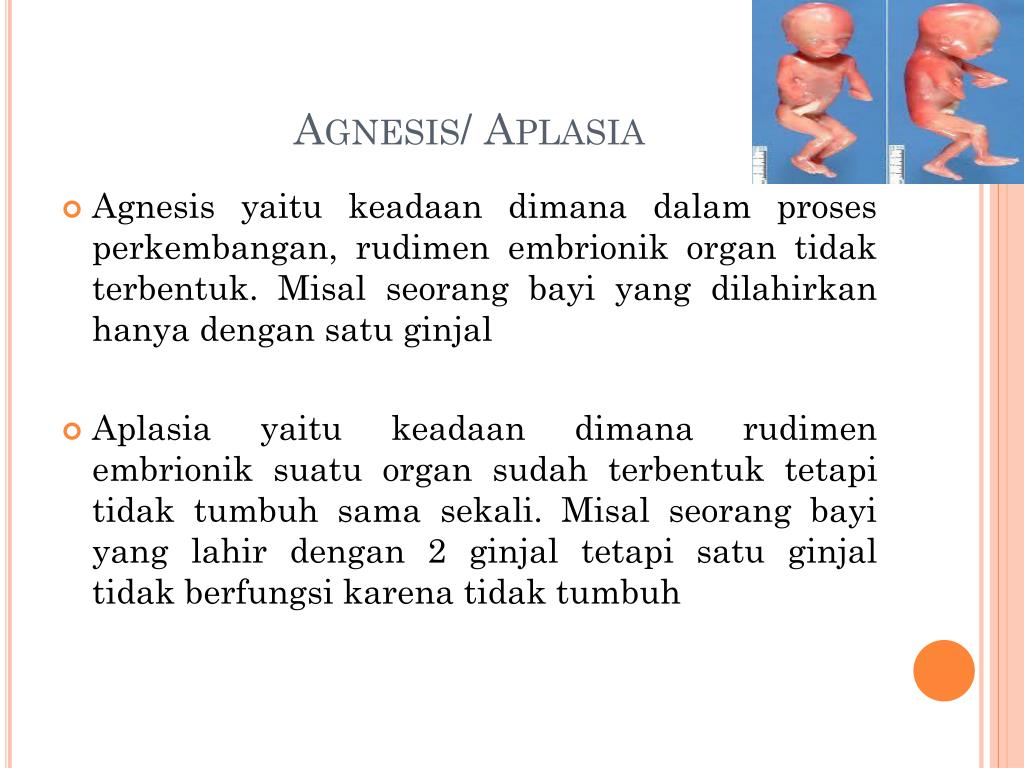 PPT - GANGGUAN PERTUMBUHAN, PROLIFERASI DAN DIFERENSIASI SEL PowerPoint ...