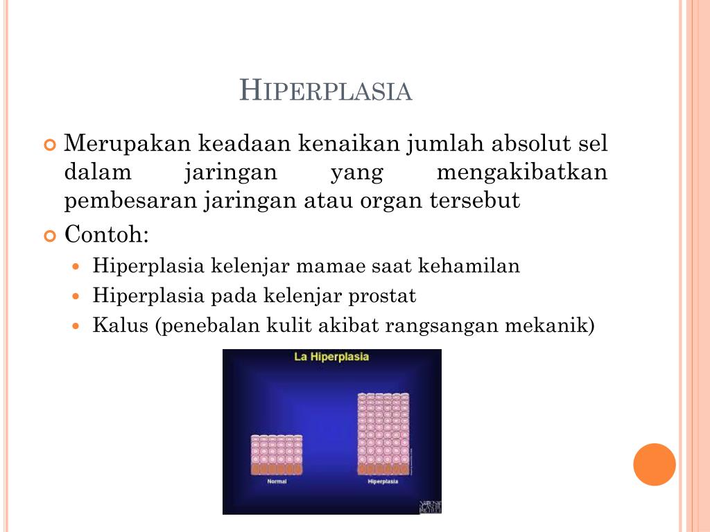 PPT - GANGGUAN PERTUMBUHAN, PROLIFERASI DAN DIFERENSIASI SEL PowerPoint ...
