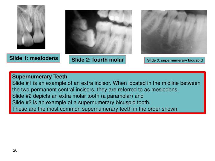 PPT - Essentials of Oral Pathology Volume I PowerPoint Presentation ...