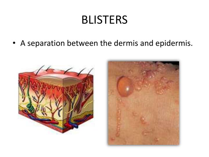 PPT - INTEGUMENTARY SYSTEM PowerPoint Presentation - ID:5977030