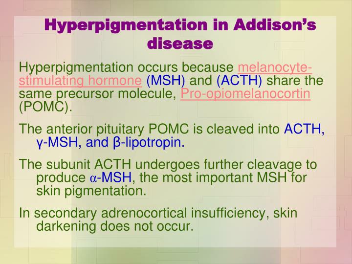 PPT - Biochemistry of Addison’s Disease PowerPoint Presentation - ID ...