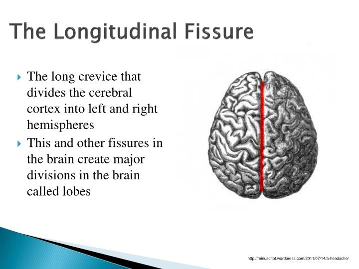 PPT - The Nervous System and The Brain PowerPoint Presentation - ID:5986027