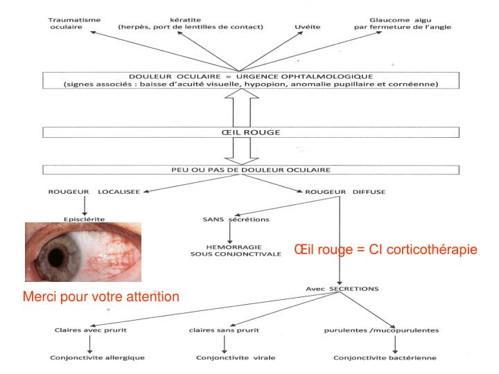 PPT - Le L’OEIL ROUGE PowerPoint Presentation - ID:5992674