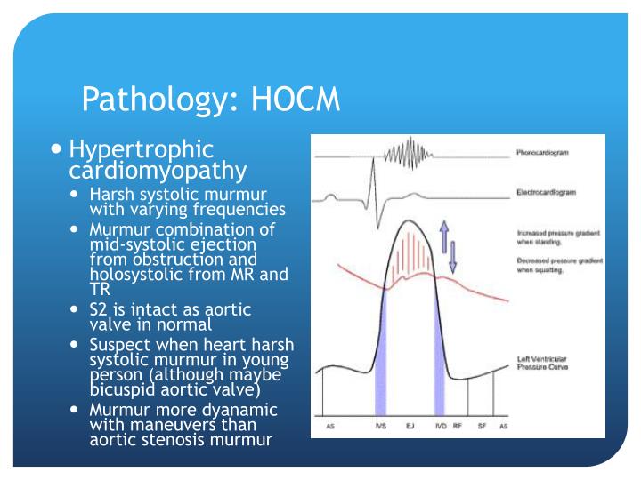 PPT - Approach to Cardiac Auscultation PowerPoint Presentation - ID:6002231