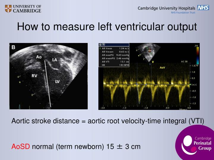 PPT - Assessing C ardiac Function PowerPoint Presentation - ID:6002659