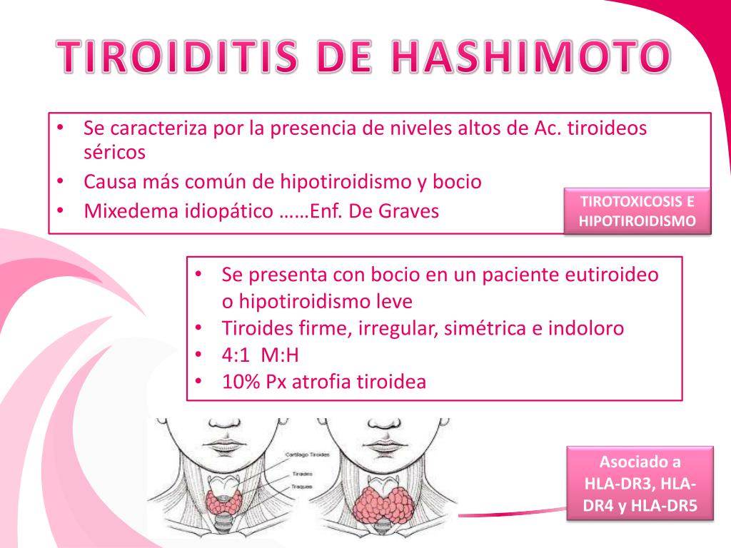 Ppt Tiroiditis Powerpoint Presentation Free Download Id 6006281