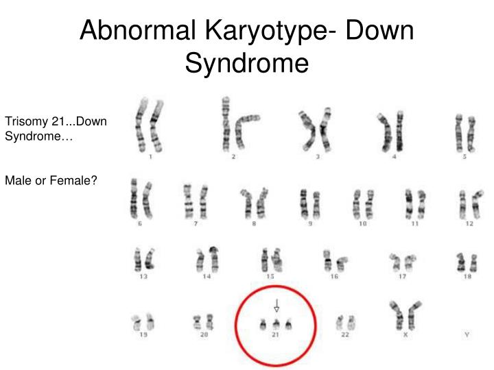 PPT - Genetic Diseases PowerPoint Presentation - ID:6007687