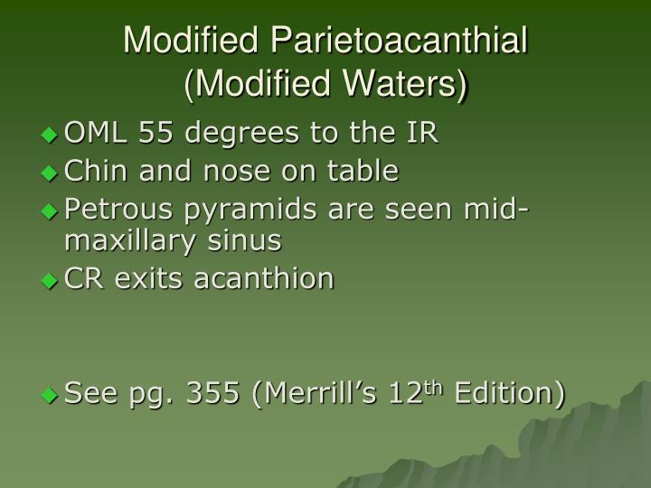 PPT - RADT 1522 Orbits, Facial Bones and Nasal Bones PowerPoint ...