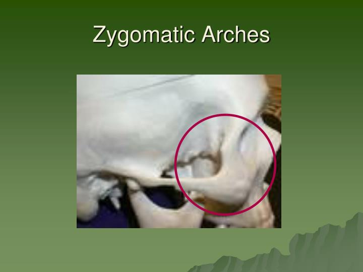PPT - RADT 1522 Orbits, Facial Bones and Nasal Bones PowerPoint ...