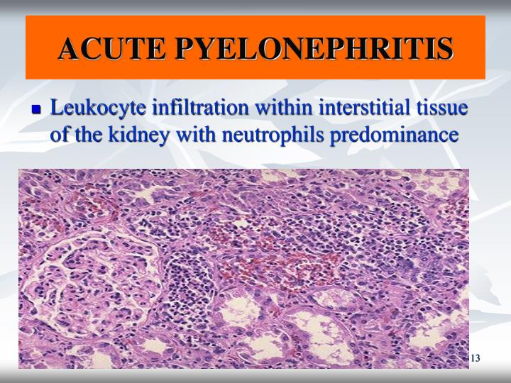 PPT - Pyelonephritis DR: Gehan Mohamed PowerPoint Presentation - ID:6010250