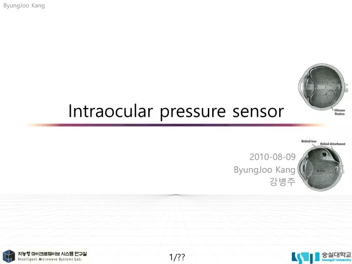 PPT - Intraocular pressure sensor PowerPoint Presentation, free ...