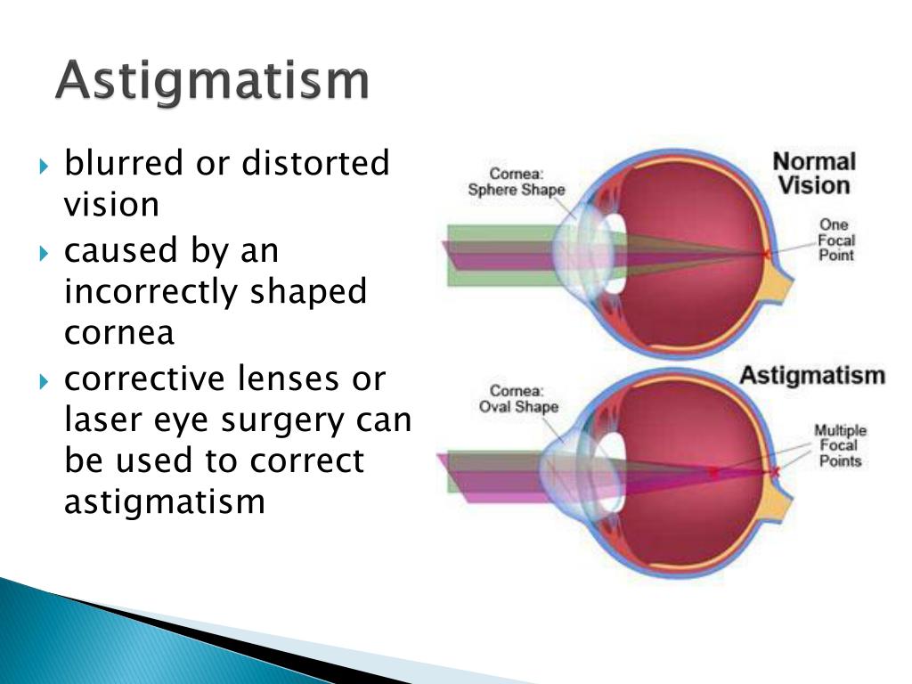 PPT - 12.3– The Human Eye PowerPoint Presentation, free download - ID ...
