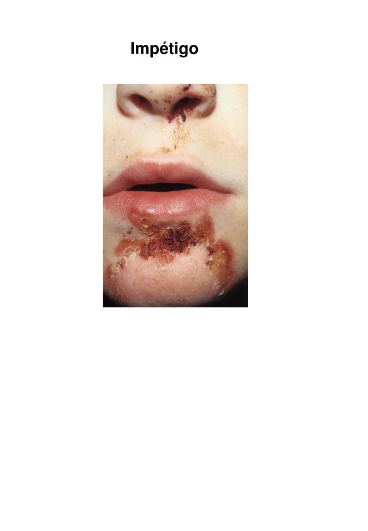 PPT - Les streptocoques PowerPoint Presentation - ID:6021071