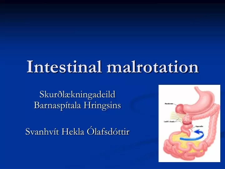 PPT - Intestinal malrotation PowerPoint Presentation, free download ...